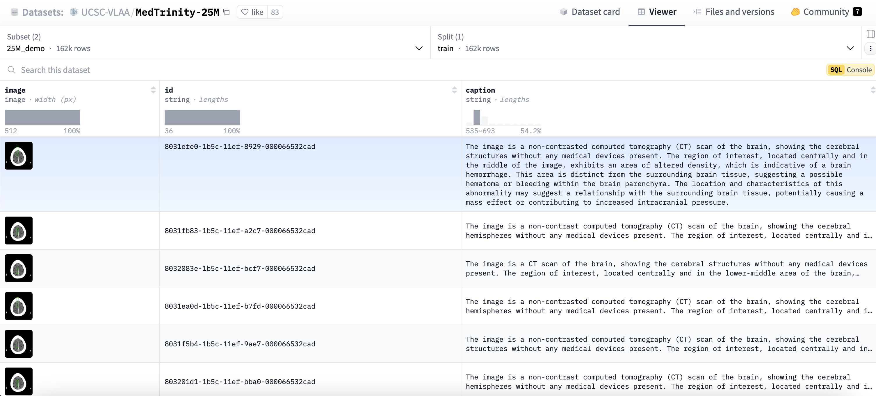 【项目实战】通过LLaMaFactory+Qwen2-VL-2B微调一个多模态医疗大模型-阿里云开发者社区