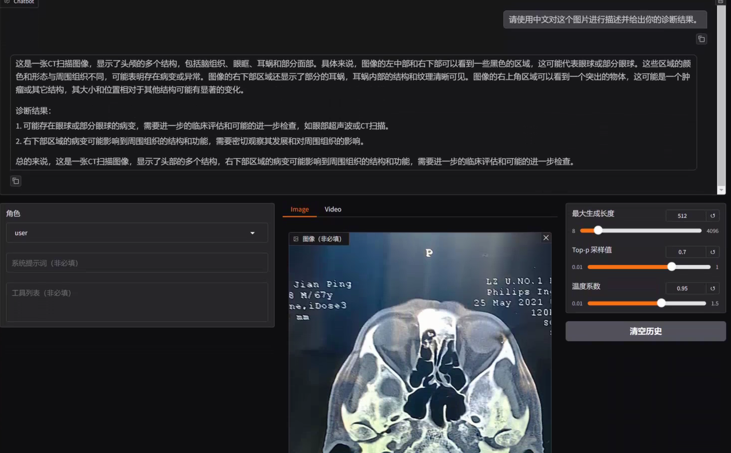 【项目实战】通过LLaMaFactory+Qwen2-VL-2B微调一个多模态医疗大模型-阿里云开发者社区