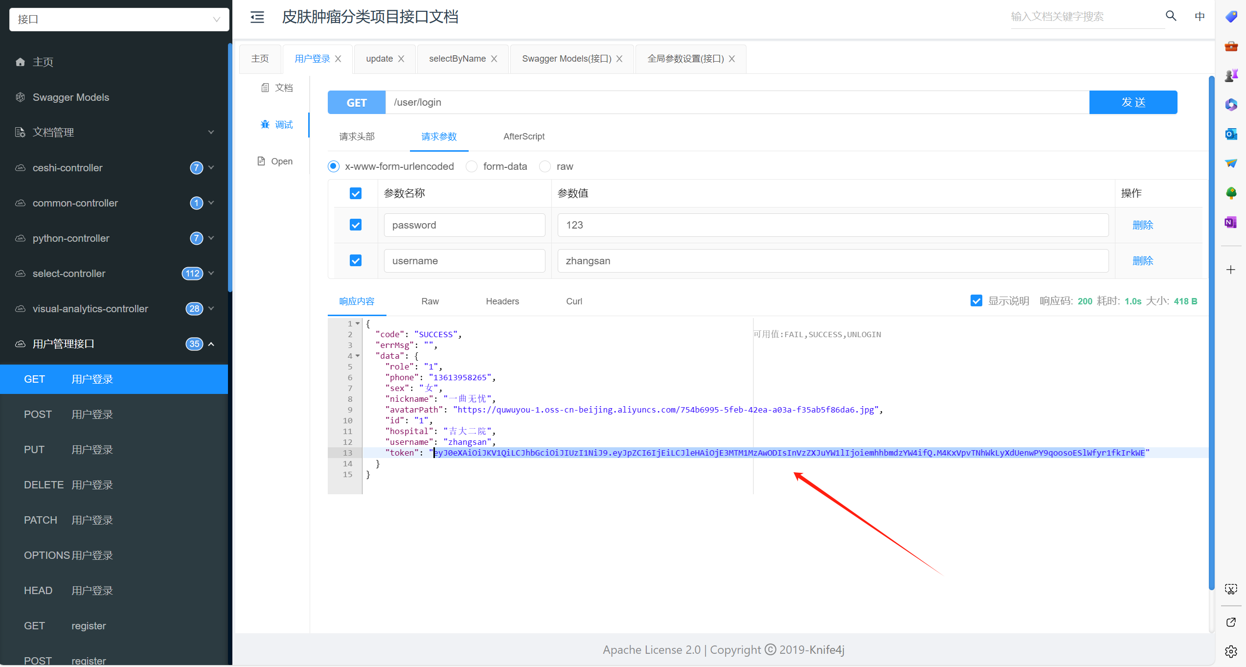 Swagger接口文档 —— 手把手教学，全方位超详细小白能看懂，百分百能用Java版-阿里云开发者社区