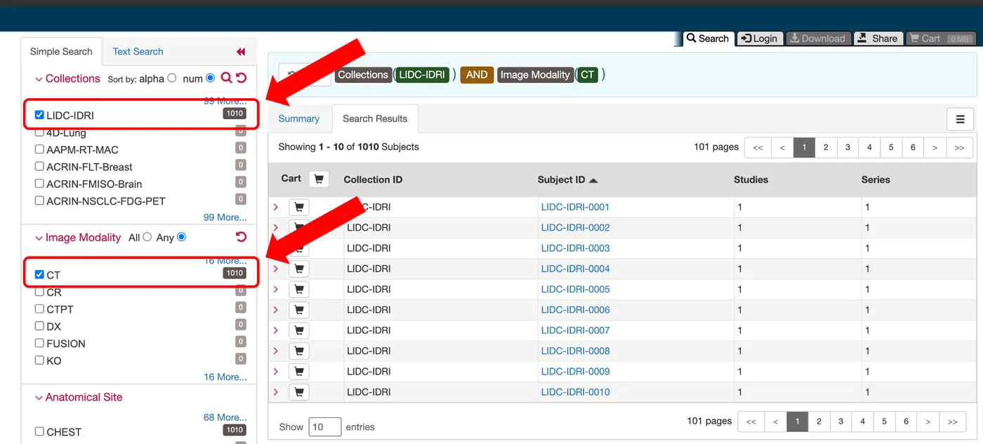 使用Python实现LIDC-IDRI肺结节数据集的预处理与分割-开发者社区-阿里云
