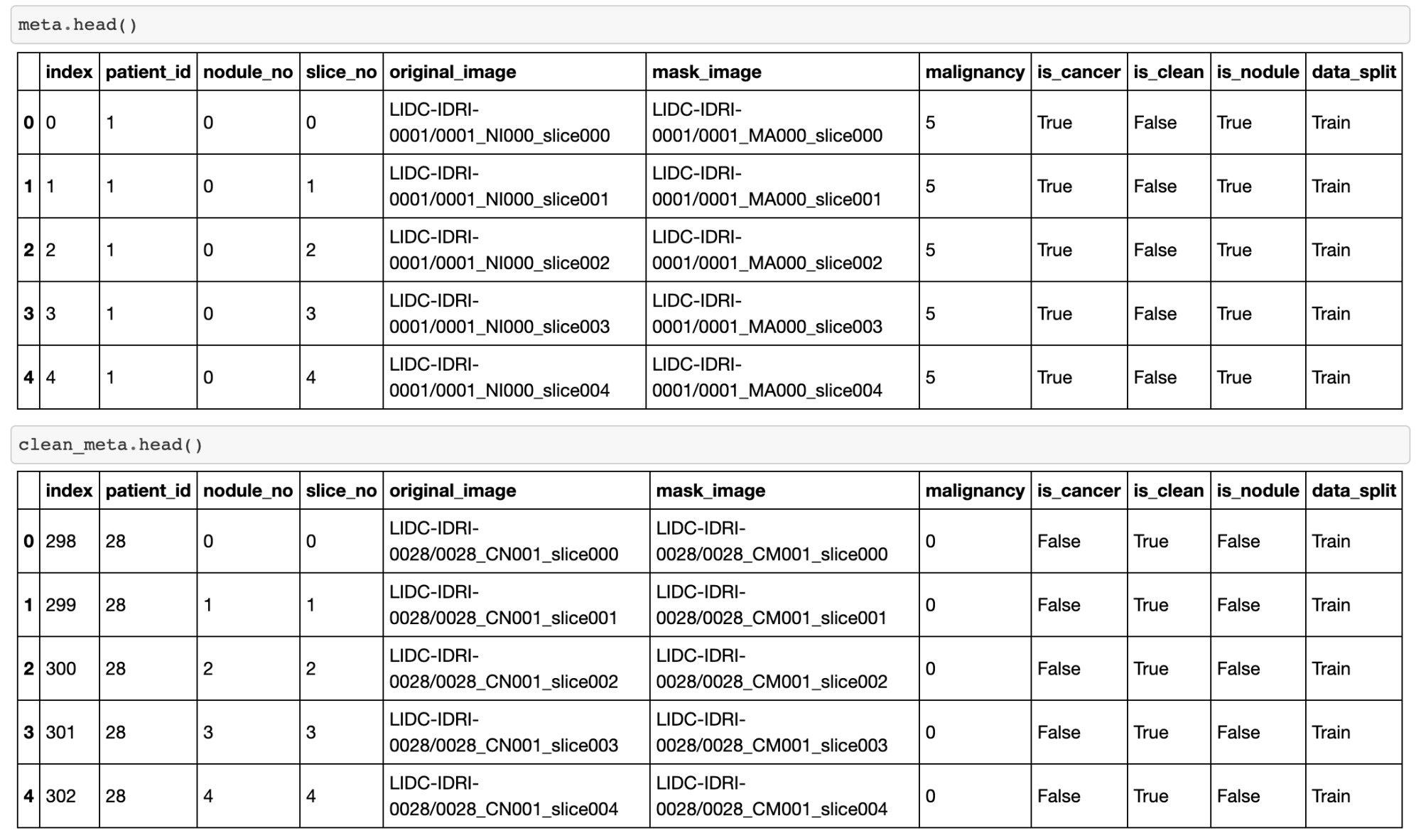 LIDC-IDRI肺结节数据集分割策略-阿里云开发者社区