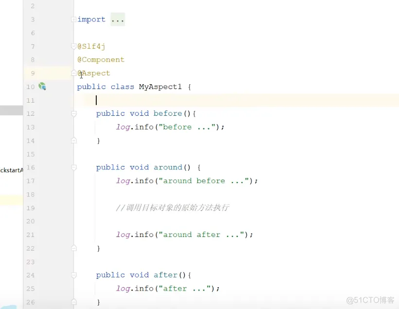 java202304java学习笔记第五十七天员工管理-Aop基础-Aop进阶1-阿里云开发者社区