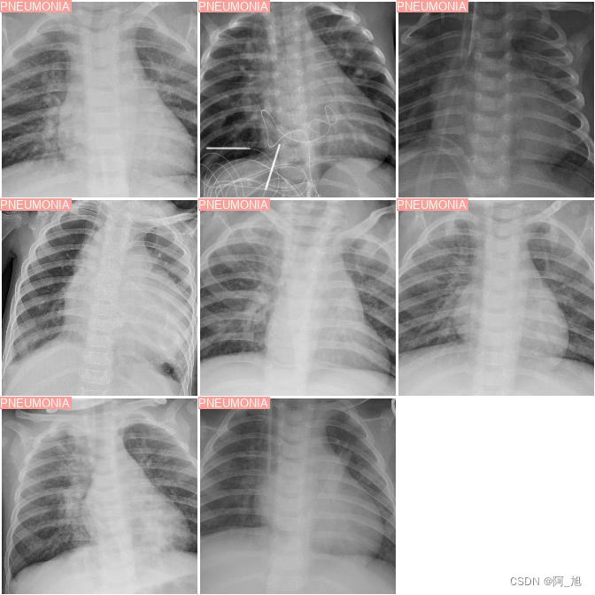 基于yolov8深度学习的智能肺炎诊断系统【python源码pyqt5界面数据集训练代码】深度学习实战 阿里云开发者社区
