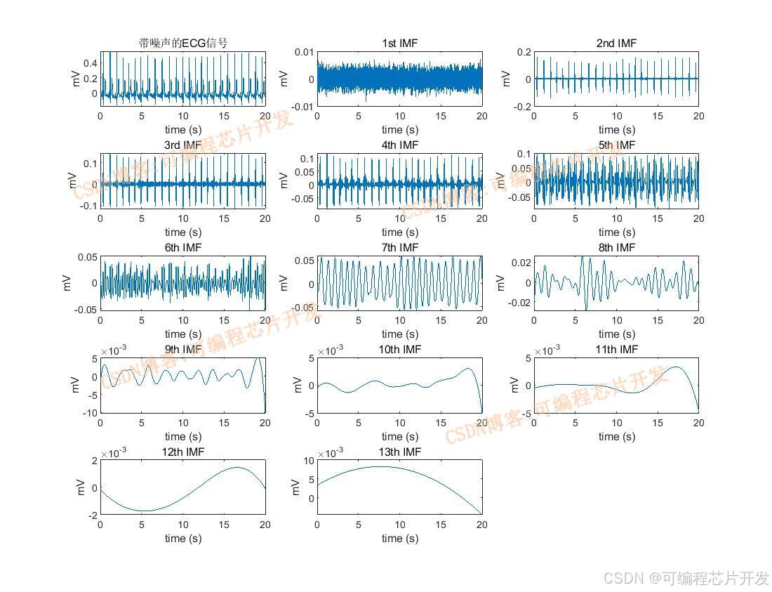 基于EEMD变换的ECG心电信号去噪和心率估计matlab仿真-阿里云开发者社区