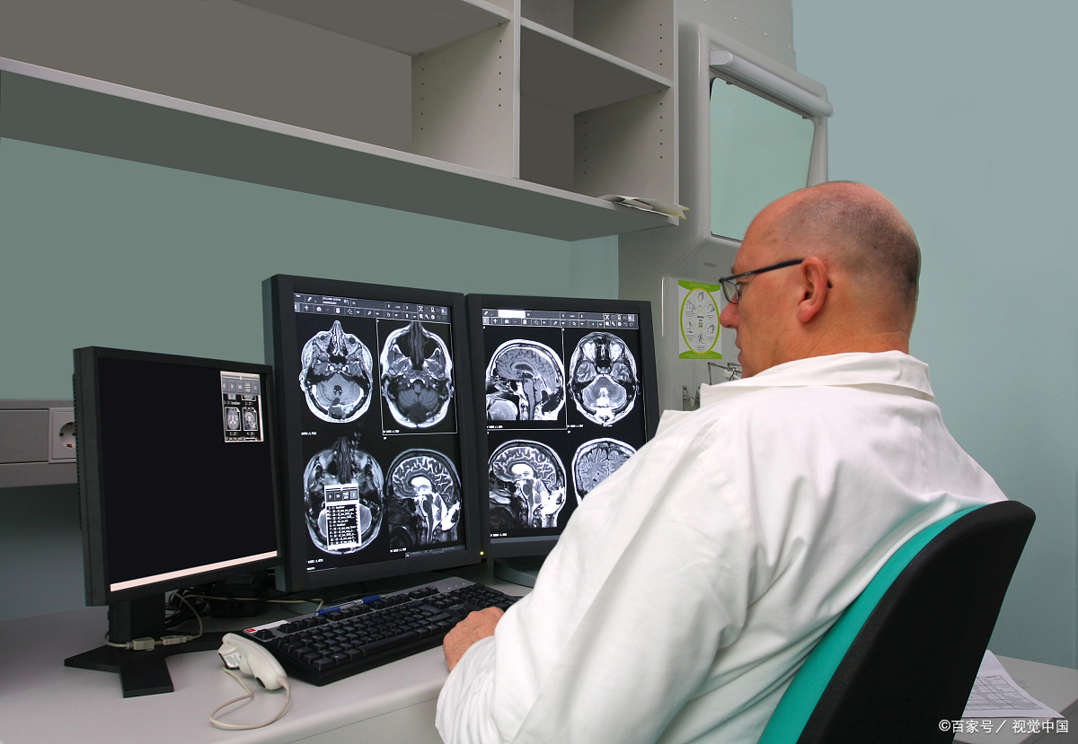 医学影像管理系统源码（PACS） PACS源码 PACS管理系统源码-阿里云开发者社区