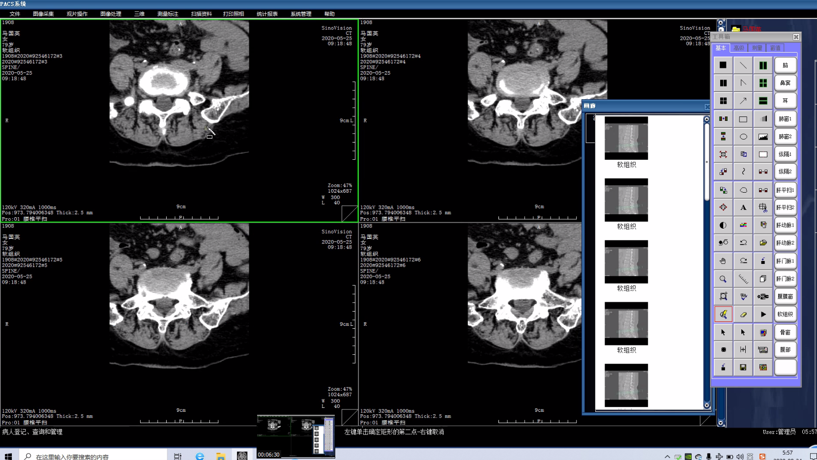 PACS系统源码 大型医院PACS源码 支持专业三维影像后处理功能-阿里云开发者社区