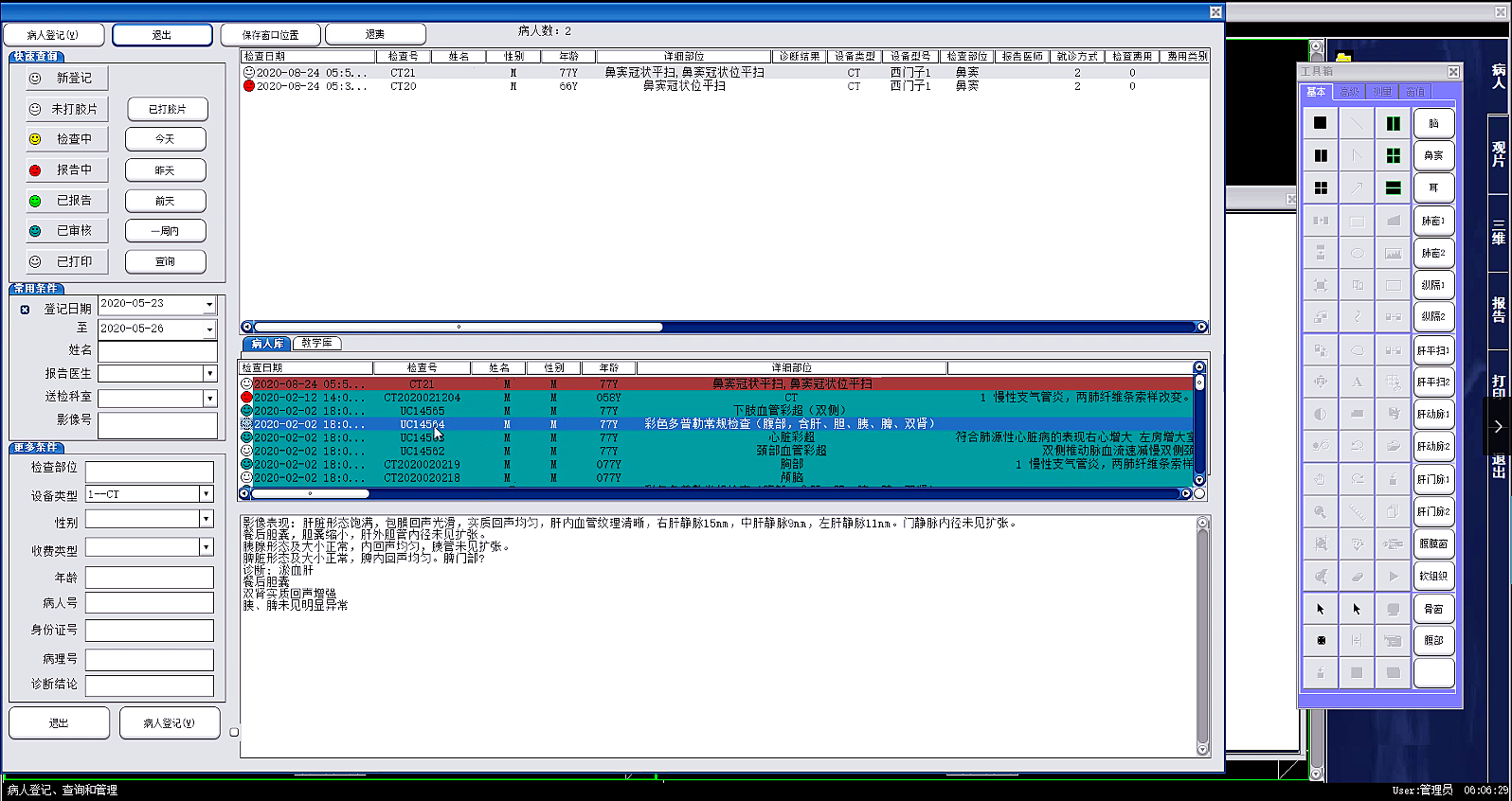 医院PACS系统源码（三维多平面重建、三维容积重建、三维表面重建、三维虚拟内窥镜）-阿里云开发者社区