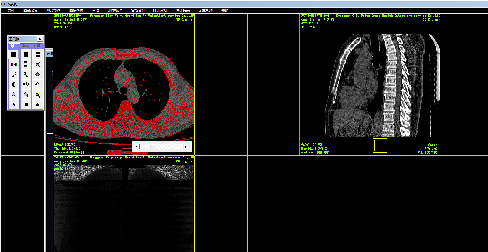 影像医学PACS系统源码带高级影像后处理功能（三维重建+还原）-阿里云开发者社区