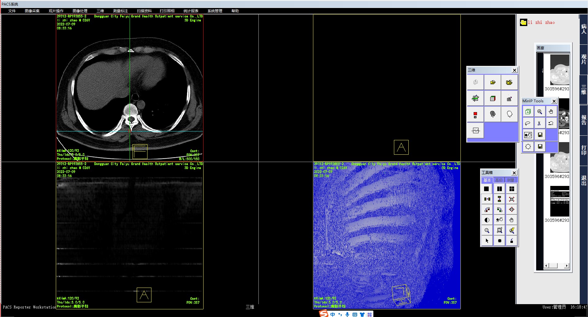 影像医学PACS系统源码带高级影像后处理功能（三维重建+还原）-阿里云开发者社区
