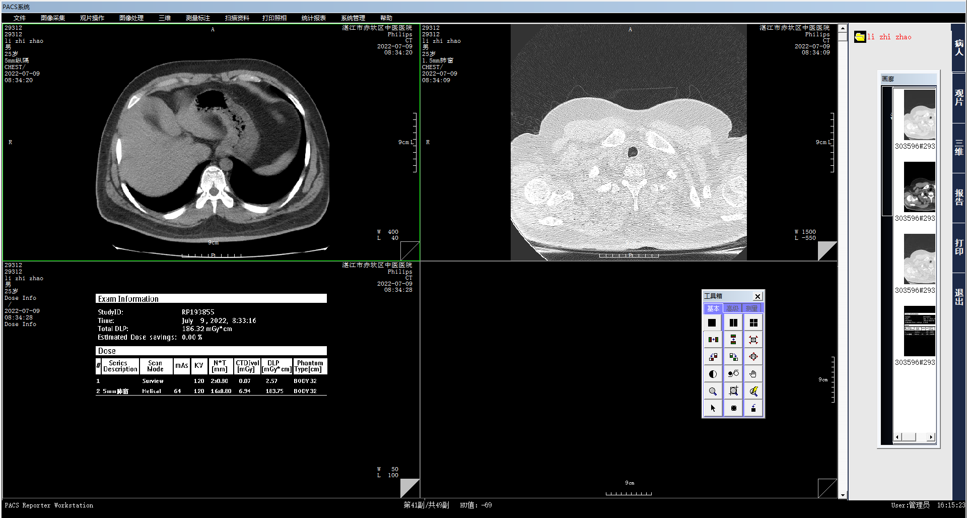 影像医学PACS系统源码带高级影像后处理功能（三维重建+还原）-阿里云开发者社区