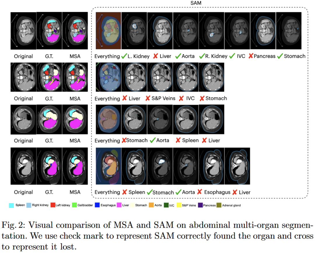 视觉大模型系列 | MSA：一种简单强大的医学 SAM 适配器，轻松强化 SAM 到指定领域-阿里云开发者社区