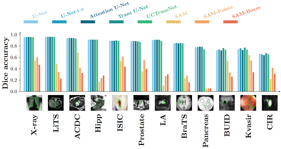 视觉大模型系列 | MSA：一种简单强大的医学 SAM 适配器，轻松强化 SAM 到指定领域-阿里云开发者社区