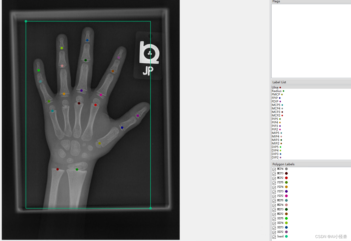 YOLO11-pose关键点检测：训练实战篇 | 自己数据集从labelme标注到生成yolo格式的关键点数据以及训练教程-阿里云开发者社区