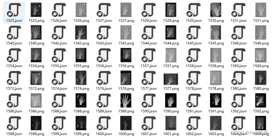 YOLO11-pose关键点检测：训练实战篇 | 自己数据集从labelme标注到生成yolo格式的关键点数据以及训练教程-阿里云开发者社区