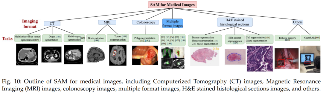 分割一切模型SAM首篇全面综述：28页、200+篇参考文献（1）-阿里云开发者社区