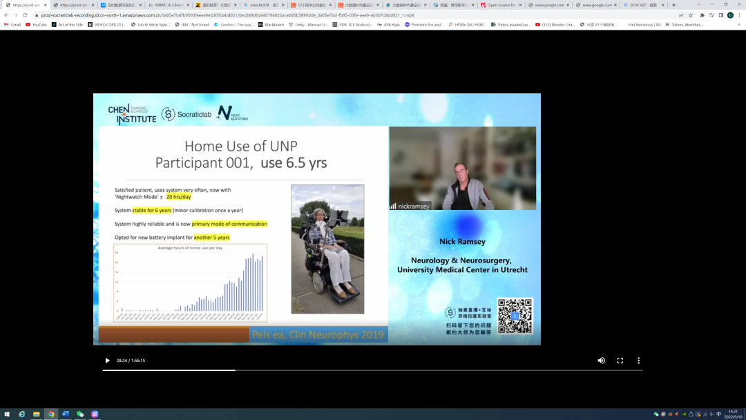 中外专家共同论道 | 人脑与机器渐行渐近，脑机接口「黑科技」照进现实-阿里云开发者社区